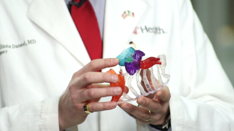 Endoscopic Heart Valve Surgery and 3D Modeling