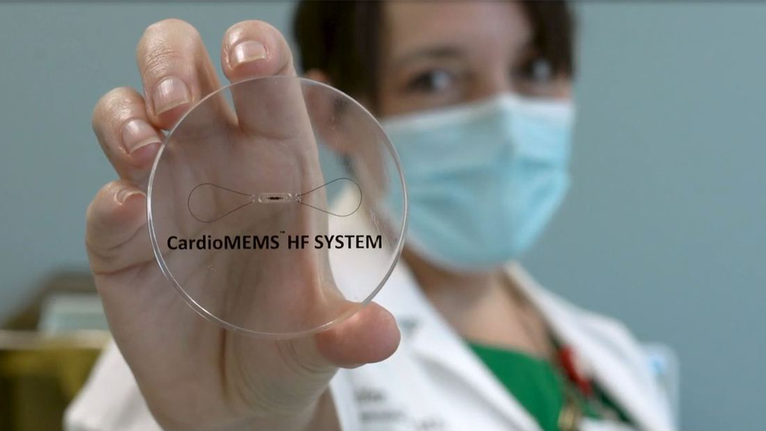 CardioMEMS Remote Monitoring For Heart Failure Patients